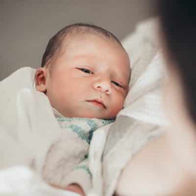 ¿Qué es un onfalocele? Posibles causas y diagnóstico